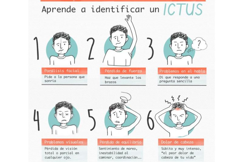 LA PRENSA | Diario - ¿Qué es un ictus?